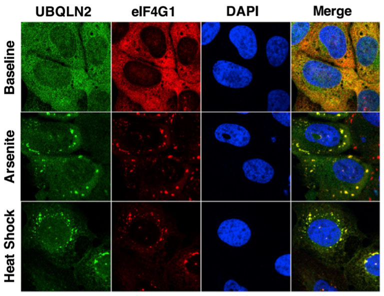 Liquid-Liquid Phase Separation in Protein Quality Control – Castañeda Lab